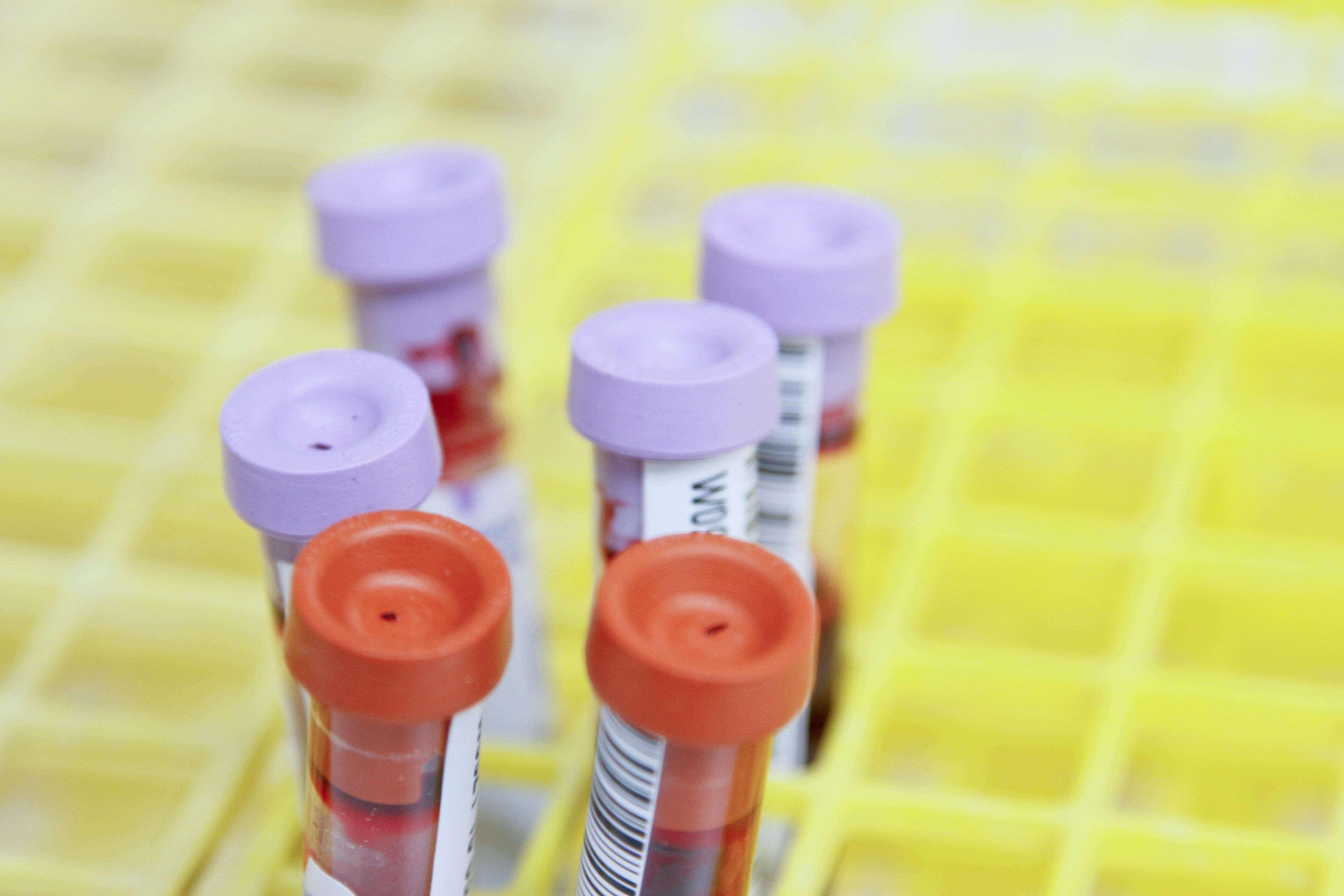 Why Blood Testing Is One of the Smartest Things You Can Do for Your He ...